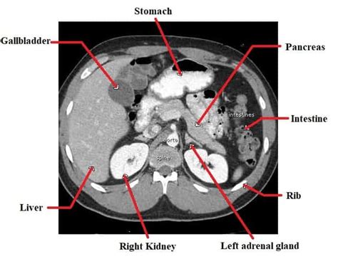 Normal Abdominal Ct New