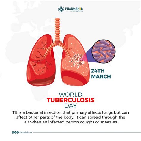 Tuberculosis Tb Is A Bacterial Infection Caused By Mycobacterium Tuberculosis It Primarily