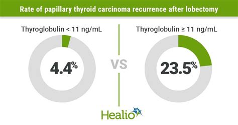 Serum Thyroglobulin May Be Strong Predictor For Papillary Thyroid