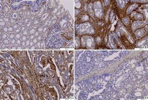 A Secreted Protein Acidic And Rich In Cysteine Sparc Is Expressed