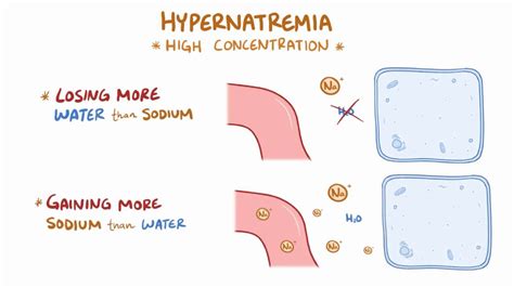 Hypernatremia Video Anatomy Definition And Function Osmosis