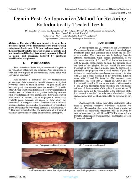 Dentin Post An Innovative Method For Restoring Endodontically Treated