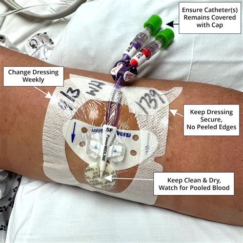 Vascular Access Patient Education Vascular Wellness