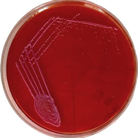 Pdf Prevalence Of Two Multidrug Resistant Klebsiella Species In An