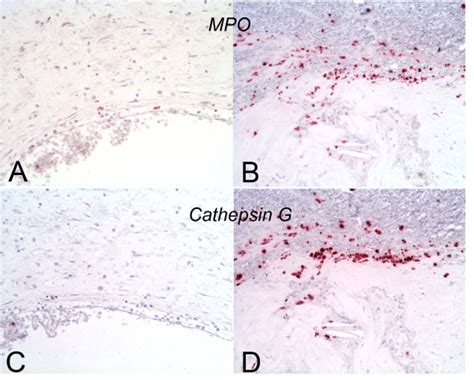Mpo Positive Cells And Neutrophils Proximal To And At Acute Rupture