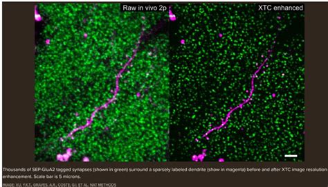 Artificialintelligence Ai Neuroscience Biomedicalengineering