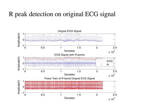 Optimal Ecg Data Compression For An E Health Transmission System Powerpoint Slides Learnpick