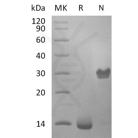 Buy Human Pdgf Bb Protein Pdgf Bb Recombinant Protein Dima Biotech