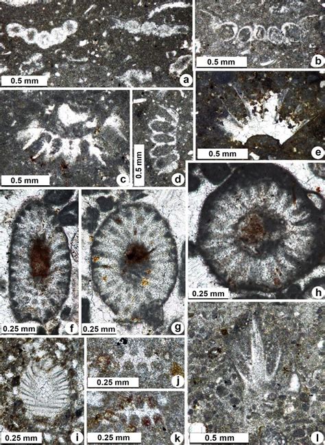 Calcareous Algae A E Actinoporella Clypeina Sp Different Sections Download Scientific Diagram