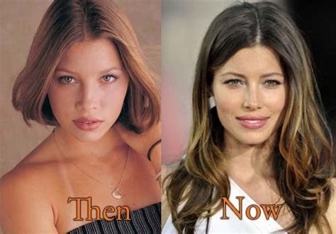 Jessica Biel Nose And Lip Job Plastic Surgery Facts