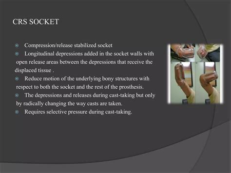 Socket Variants In Upper Extremity Prosthesis Pptx1 Pptx
