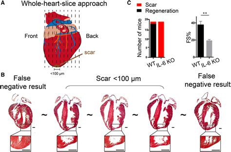 Apical Stop Adalah At Daniel Mcbryde Blog