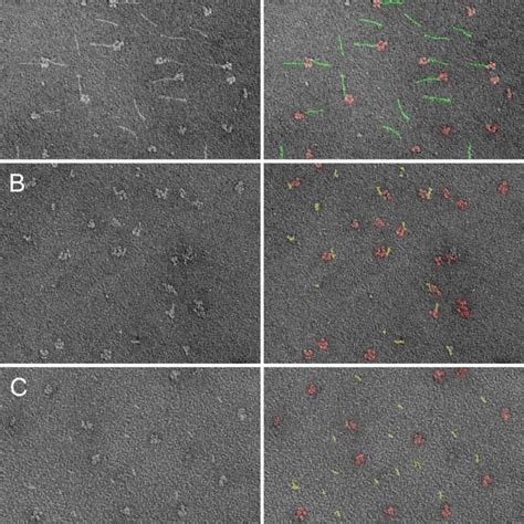 Shown Are Electron Micrographs After Negative Staining Of Hk In Complex