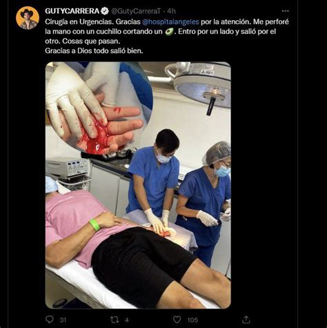 Guty Carrera se sometió a una cirugía de emergencia luego de accidentarse con un cuchillo Infobae