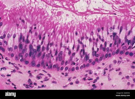 Maxillary Sinus Membrane Light Micrograph Of A Section Through A