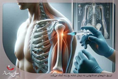 علائم و راه‌های درمان شانه یخ زده چیست؟
