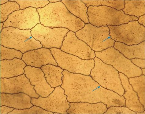 Histology Pa Exam Karteikarten Quizlet