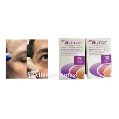 Botulinum Toxin Allergan Botox Injection For Wrinkle Remove