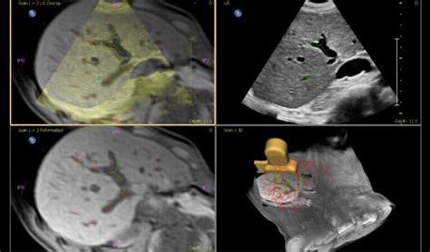 Dan Aranowitz Posted On Linkedin