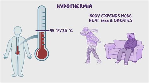 Hypothermia Clinical Sciences Osmosis Video Library
