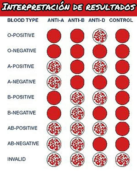Tarjeta De Eldon O Eldon Card ⬇ Tipificación Para Transfusion En Shock