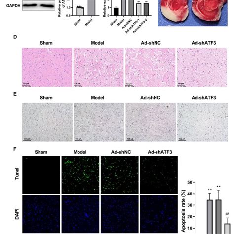 Knockdown Of Atf3 Suppressed The Pathological Injury Of Is N 6 Each