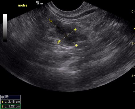Annular Colonic Mass In A 14 Year Old Mn Dsh Cat Members