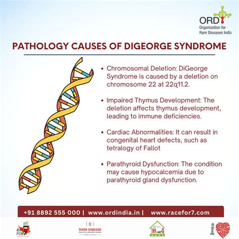 Digeorge Syndrome A Condition Rooted In A Genetic Deletion On