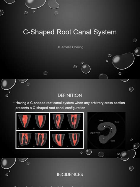 C Shaped Root Canal System Pdf Dental Anatomy Tooth