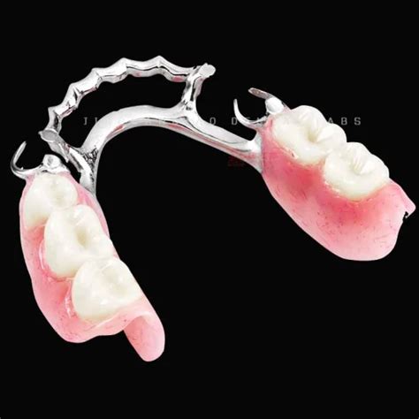 Sirona Vitallium Partial Dentures High Quality Cocr Metal Framework With Acrylic Teeth