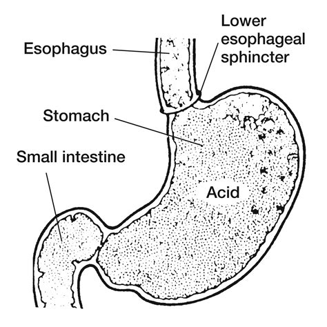 Lower Esophageal Sphincter Media Asset Niddk