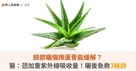臉部曬傷擦蘆薈能緩解？醫：恐加重紫外線吸收量！曬後急救3秘訣 華人健康網 專業即時優質的健康新聞及資訊分享平台業即時優質的健康新聞及