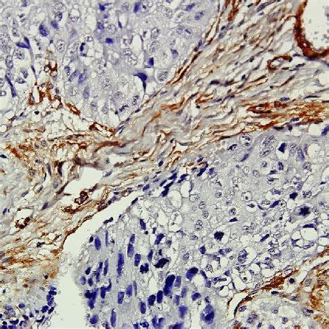 Network And Spindle Arrangement Of Myofibroblasts Download Scientific Diagram