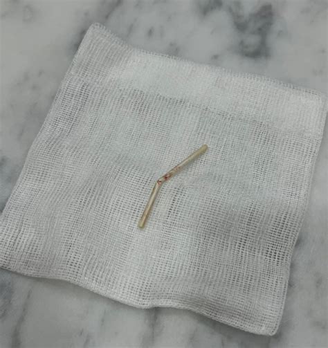 임플라논 시술 후 3년 채운뒤 제거한 후기 제거한 임플라논 실물 사진 첨부 네이버 블로그