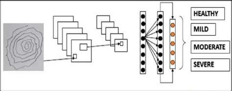 Figure From Parkinsons Disease Detection And Classification Of