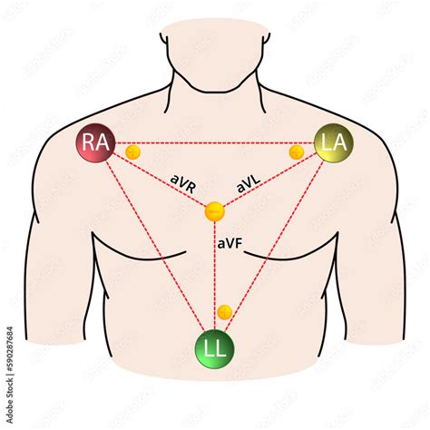 Augmented Limb Leads Ecg Einthoven Triangle Electrocardiogram