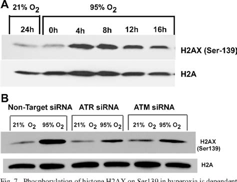 Figure 7 From Differential Roles Of ATR And ATM In P53 Chk1 And