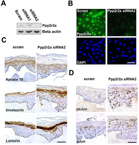 Sirna Knockdown Of Ppp2r2a Maintains Jun Phosphorylation And Causes Download Scientific Diagram