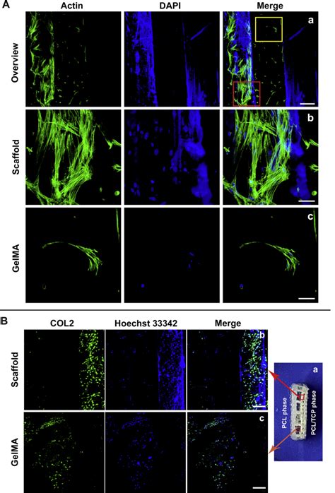 Three Dimensional Printed Multiphasic Scaffolds With Stratified Cell Laden Gelatin Methacrylate