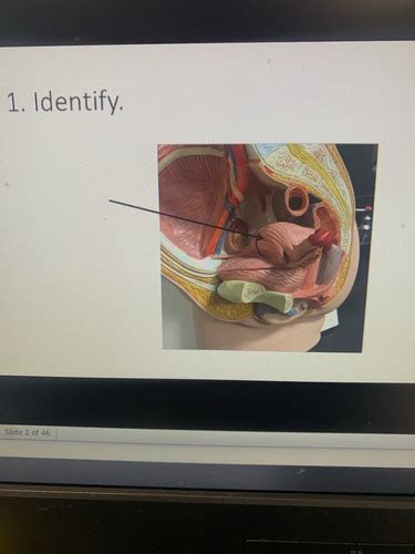 Reproductive Sys Lab Flashcards Quizlet
