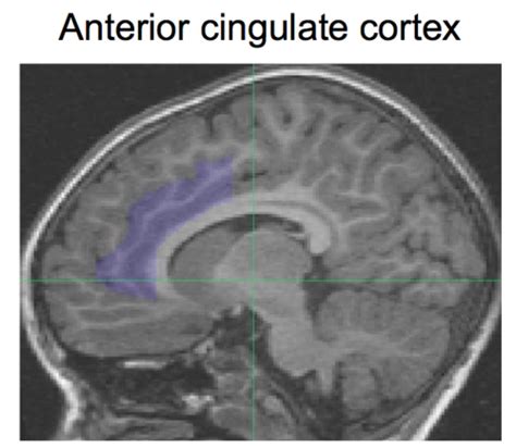 Psyc 344 Frontal Lobe And Descion Making Flashcards Quizlet