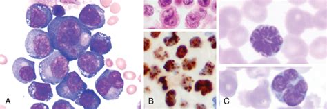 Virus Associated Lymphoma Clinical Tree