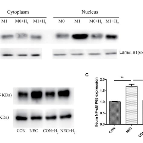 Expression Of Nf κb P65 Signaling Pathway In Raw2647 And Distal