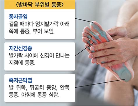 삶의 질 떨어트리는 ‘발바닥 통증… 부위별 원인 달라 백세시대