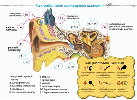 How Works A Cochlear Implant Behance