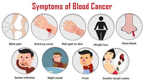 Leukemia Meaning Causes Early Symptoms Signs ImpactGuru