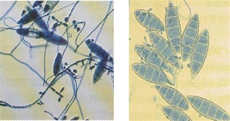 科学网环境微生物之真菌 王从彦的博文