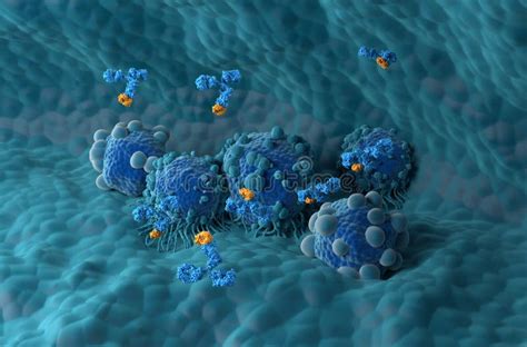 Tratamiento De Anticuerpos Monoclonales En La Visión Isométrica Del Cáncer Pancreático ...
