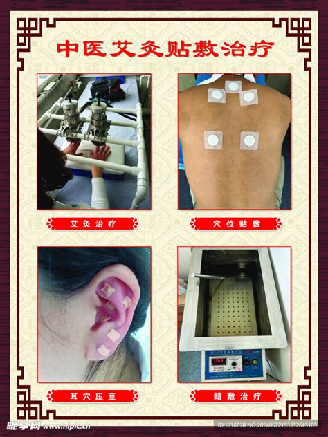 中医艾灸治疗设计图 广告设计 广告设计 设计图库 昵图网nipic