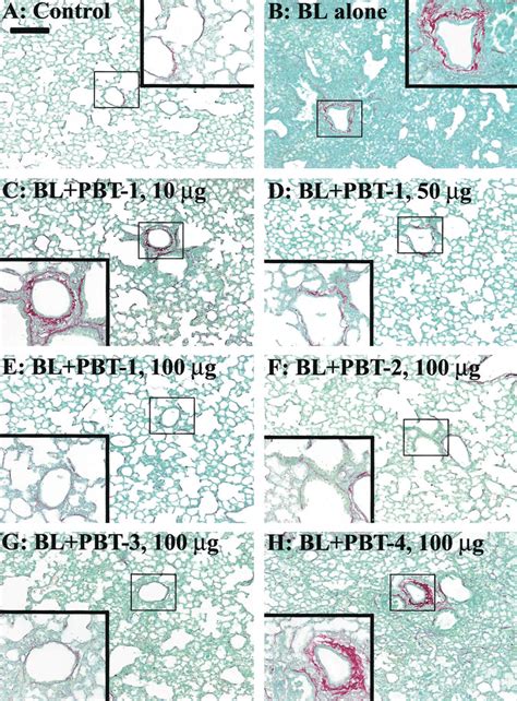 Sirius Red Staining Of Lung Sections For Collagen Mice Received Either
